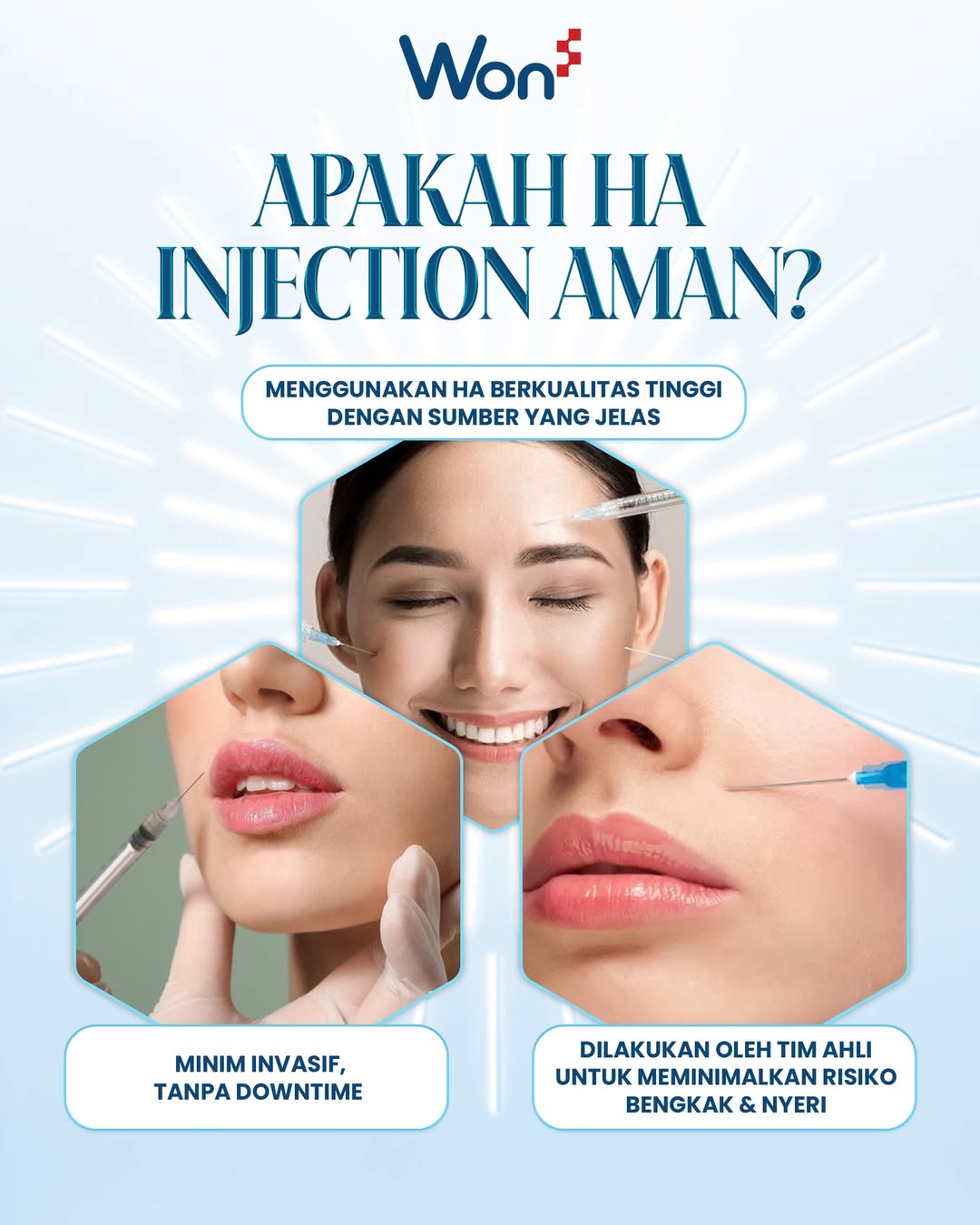 Berapa lama filler bertahan? Bagaimana cara memperpanjang efeknya ...