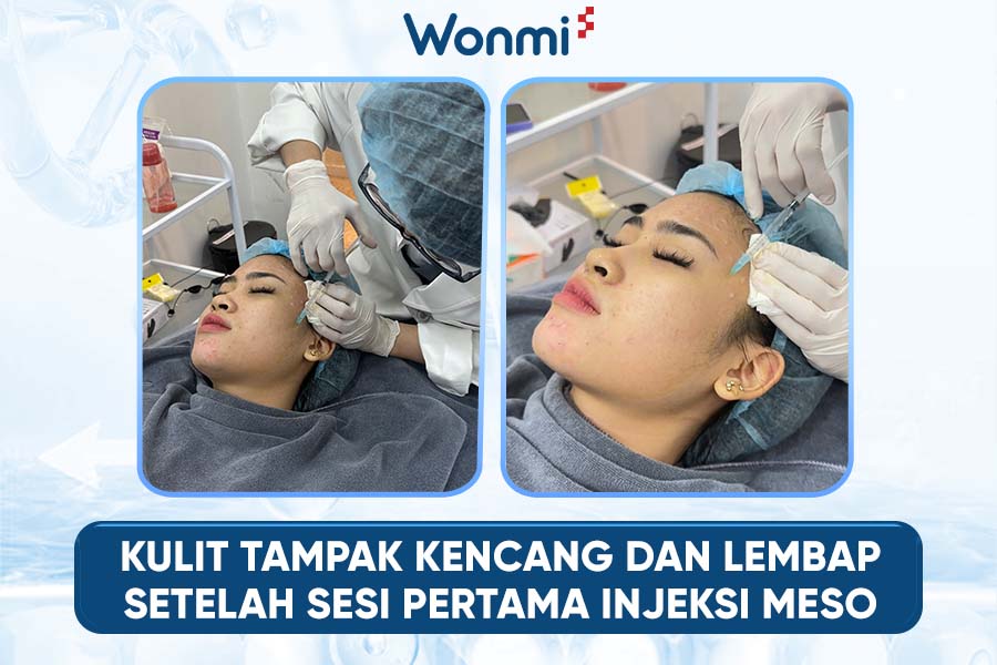 FAKTA & KESALAHPAHAMAN YANG SERING TERJADI TENTANG INJEKSI MESO EXTRA ...
